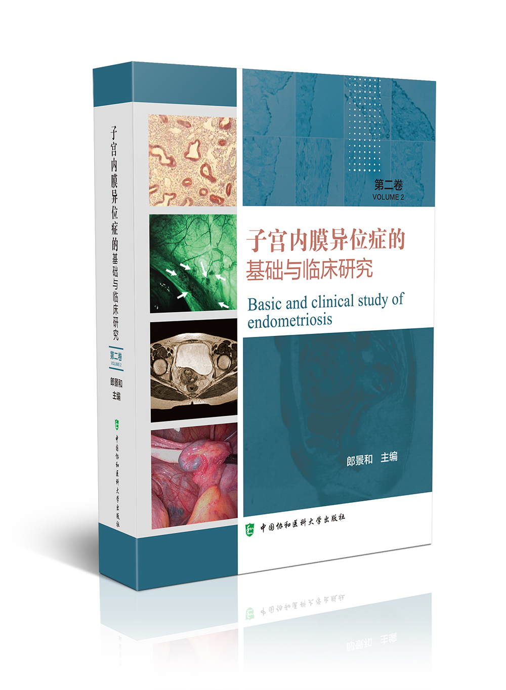 子宫内膜异位症的基础与临床研究（第二卷）