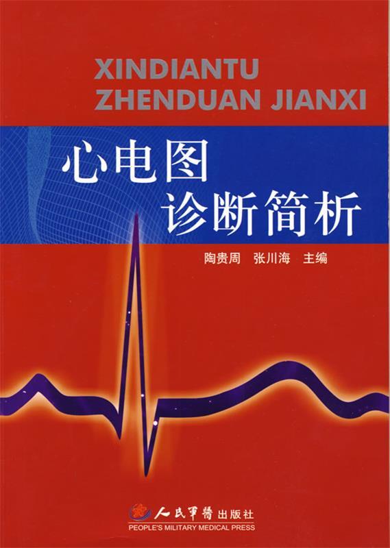 心电图诊断简析