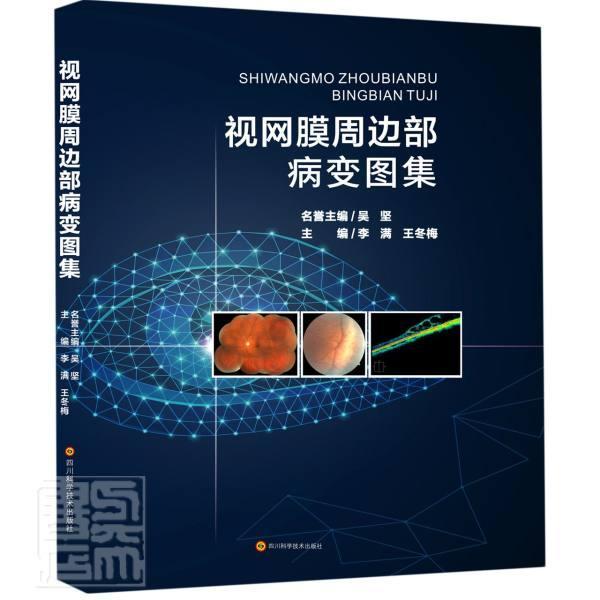 视网膜周边部病变图集者_李满王冬梅责_吴晓琳四川科学技术出版社9787572703591 医学书籍
