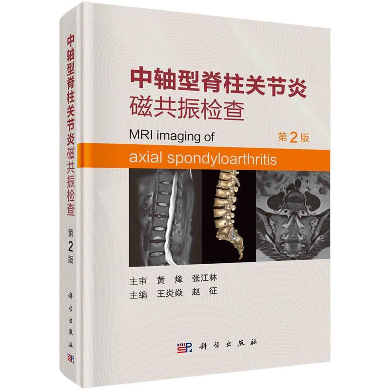 中轴型脊柱关节炎磁共振检查 王炎焱,赵征 9787030670656