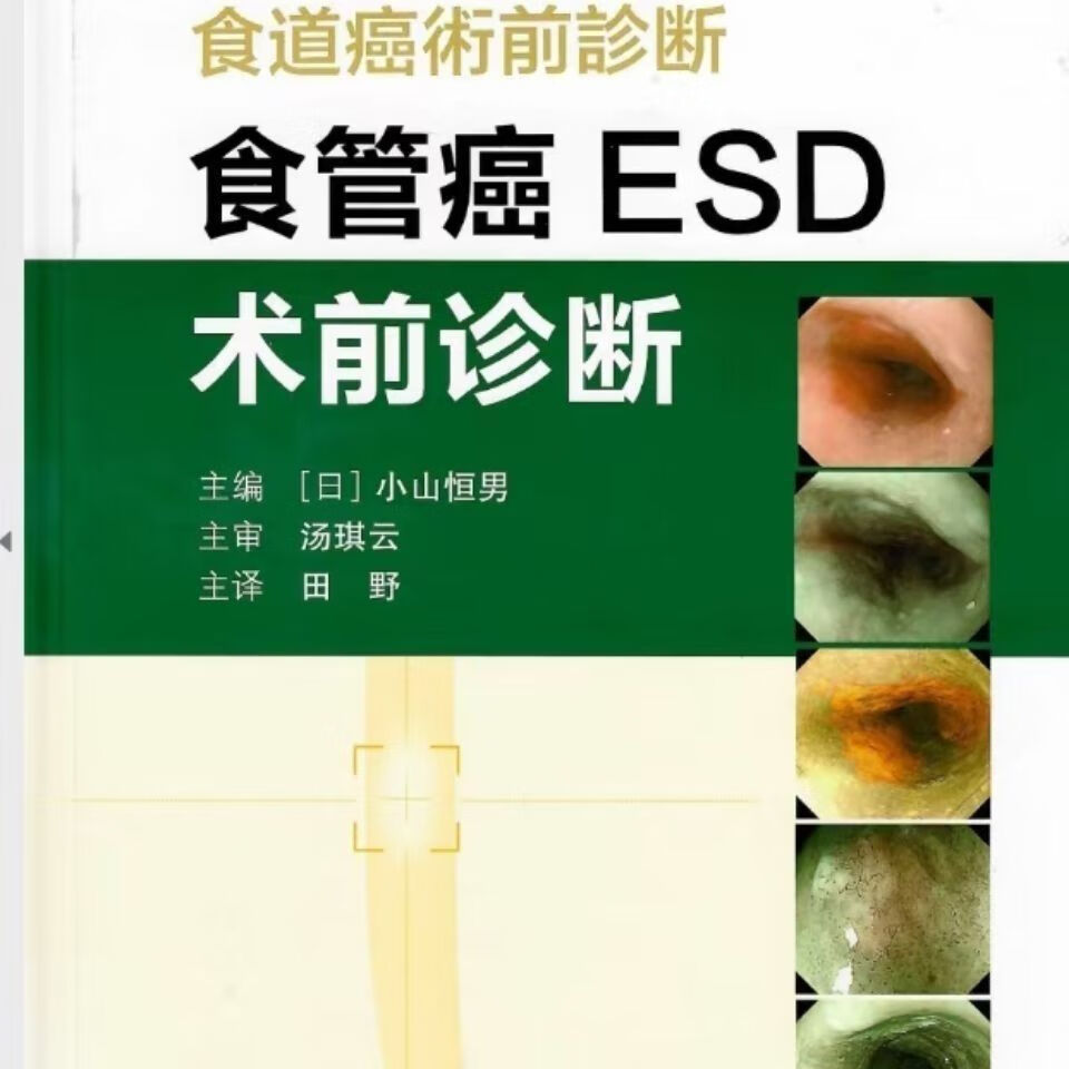 食管癌ESD术前诊断_田野主译2021年(彩图)