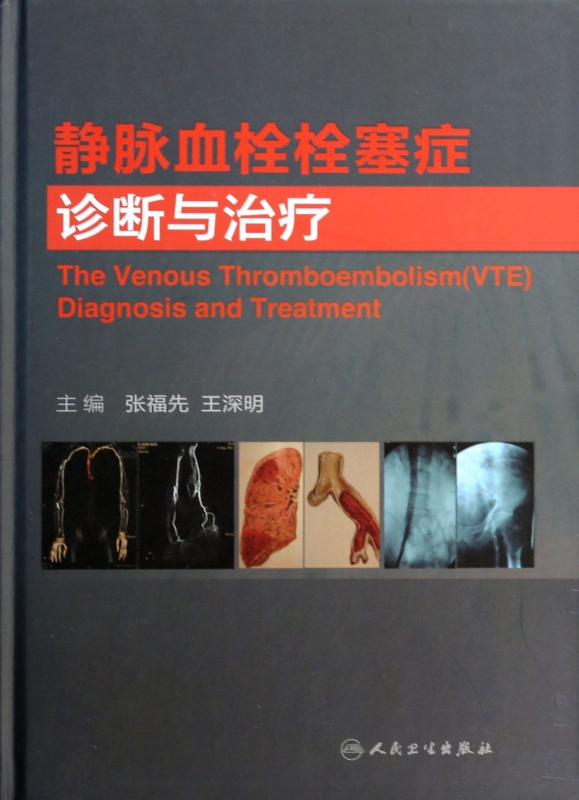 静脉血栓栓塞症诊断与治疗(精)