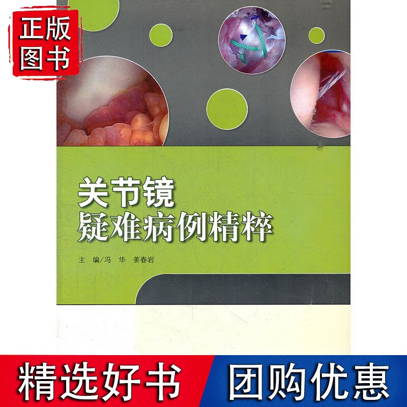 关节镜疑难病例精粹