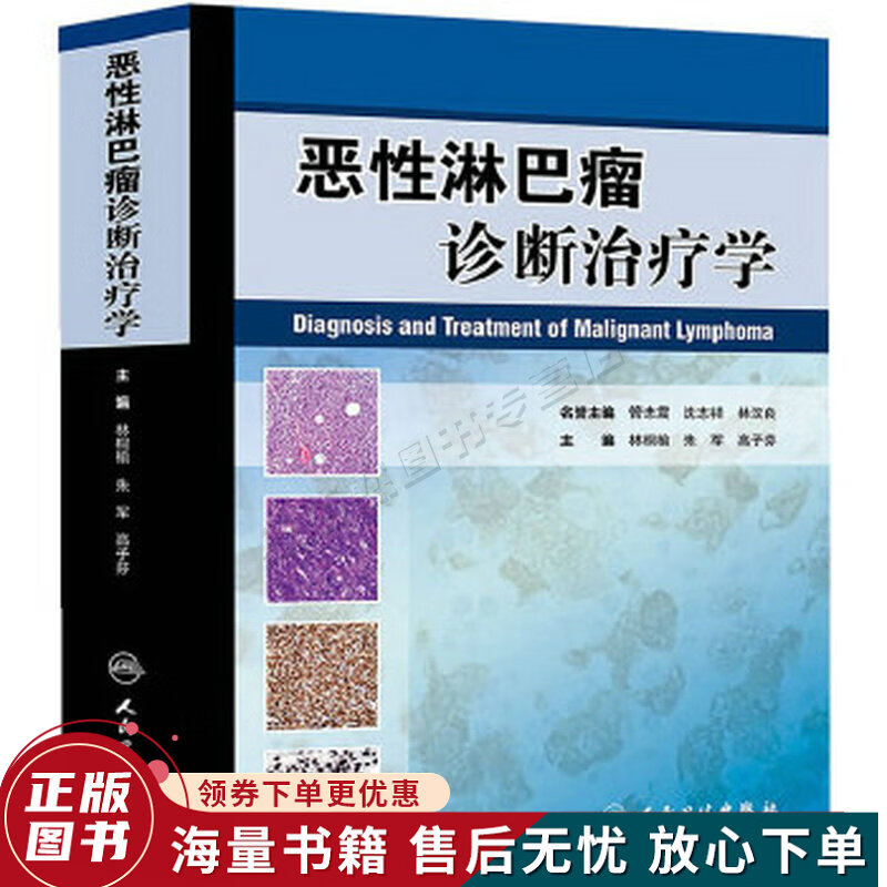 恶性淋巴瘤诊断治疗学