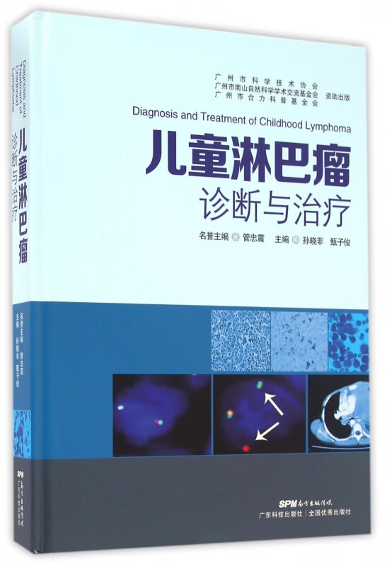 儿童淋巴瘤诊断与治疗(精)