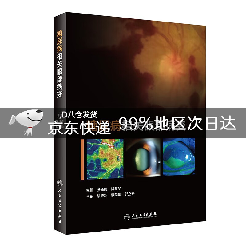 糖尿病相关眼部病变