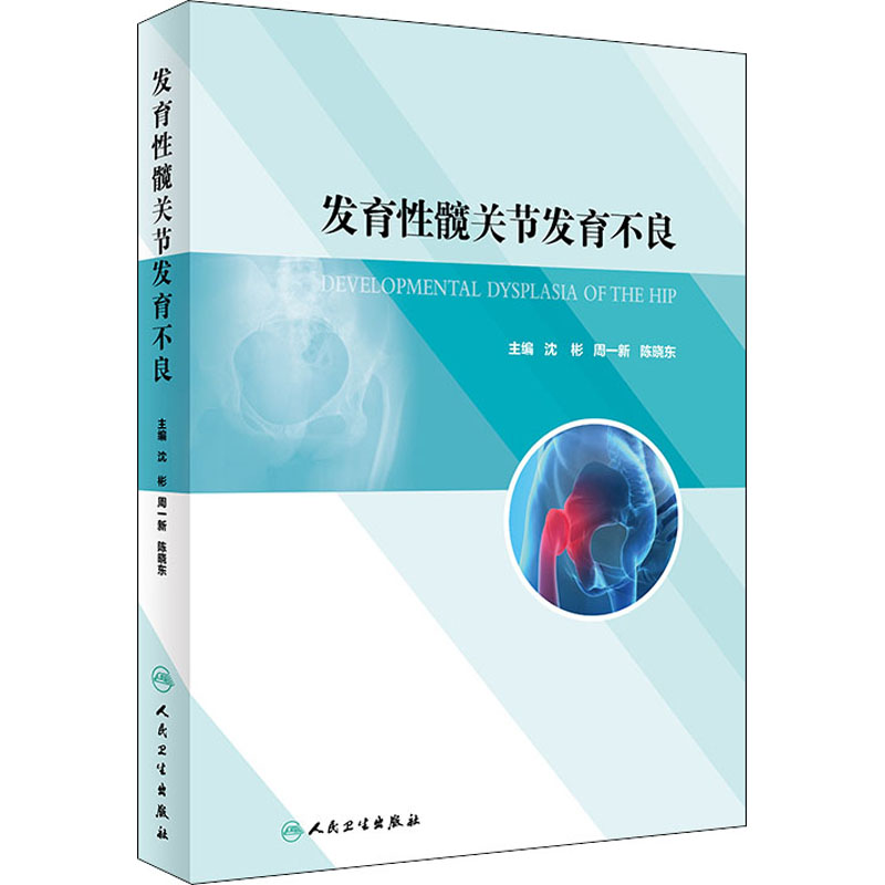发育性髋关节发育不良