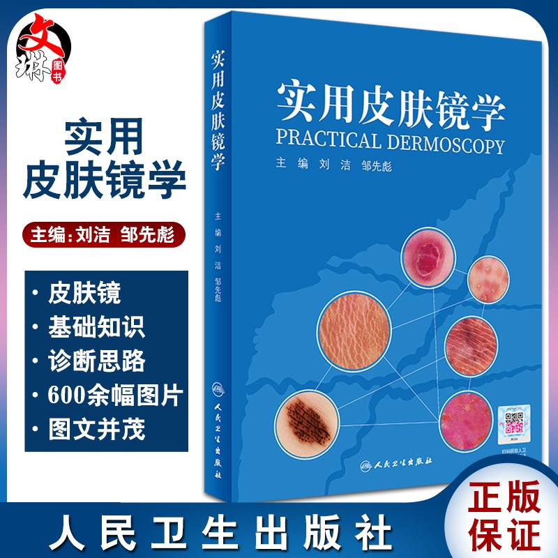 实用皮肤镜学 刘洁 邹先彪编 皮肤病学书籍 皮肤肿瘤和炎症性皮肤病的诊断方法和思路 医学临床 9787117307871
