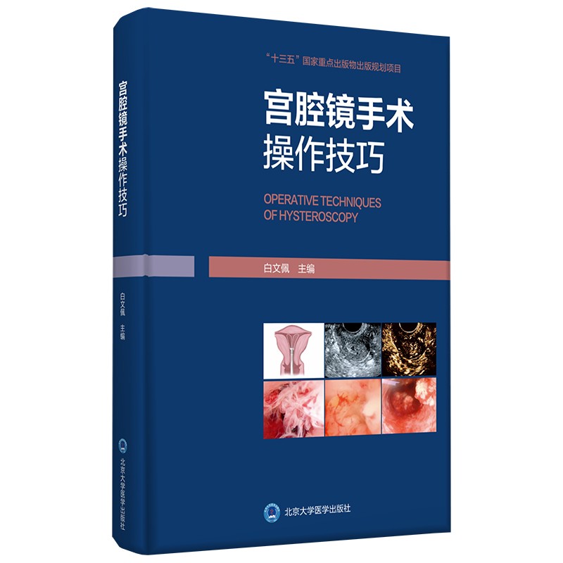 宫腔镜手术操作技巧
