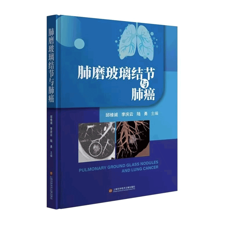 肺磨玻璃结节与肺癌 邱维诚 内科学书籍 肺部结节影像学表现 医学科普知识 上海科学技术文献出版社9787543988309