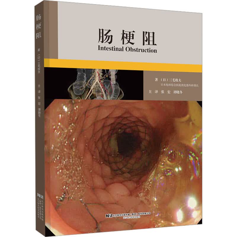 肠梗阻 图书