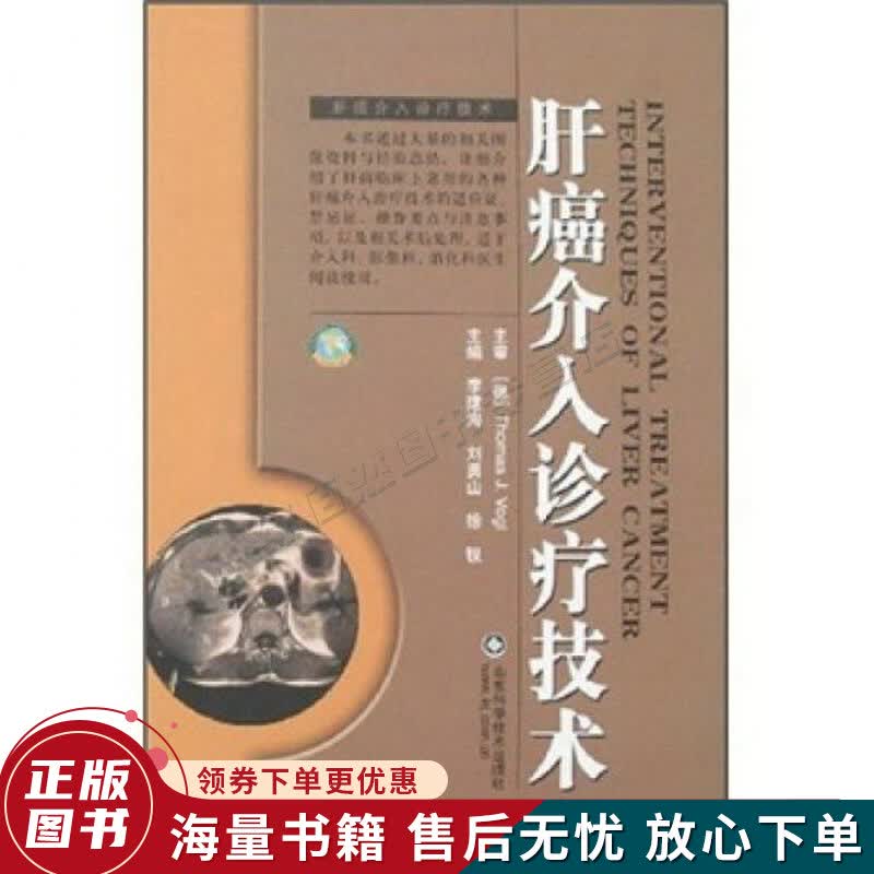 肝癌介入诊疗技术