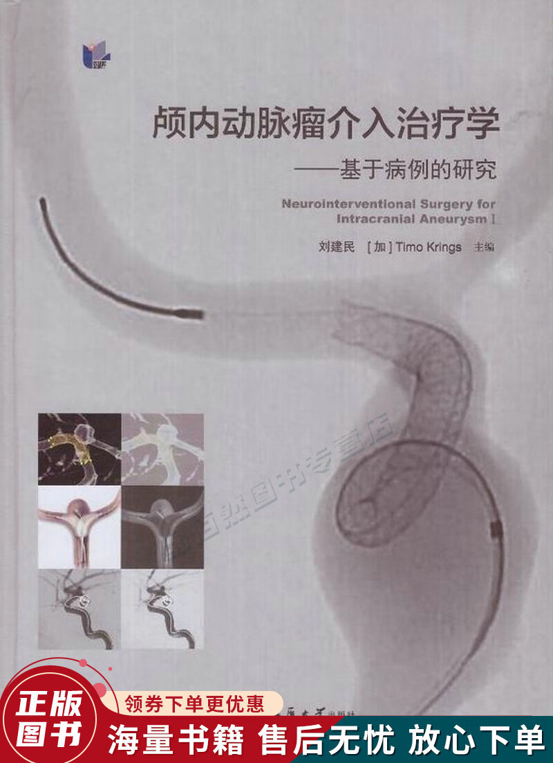 颅内动脉瘤介入治疗学：基于病例的研究