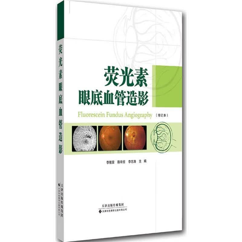 荧光素眼底血管造影 天津科技翻译出版公司