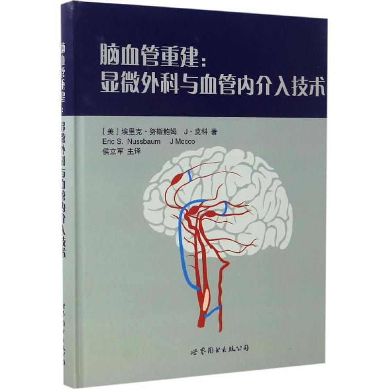 脑血管重建