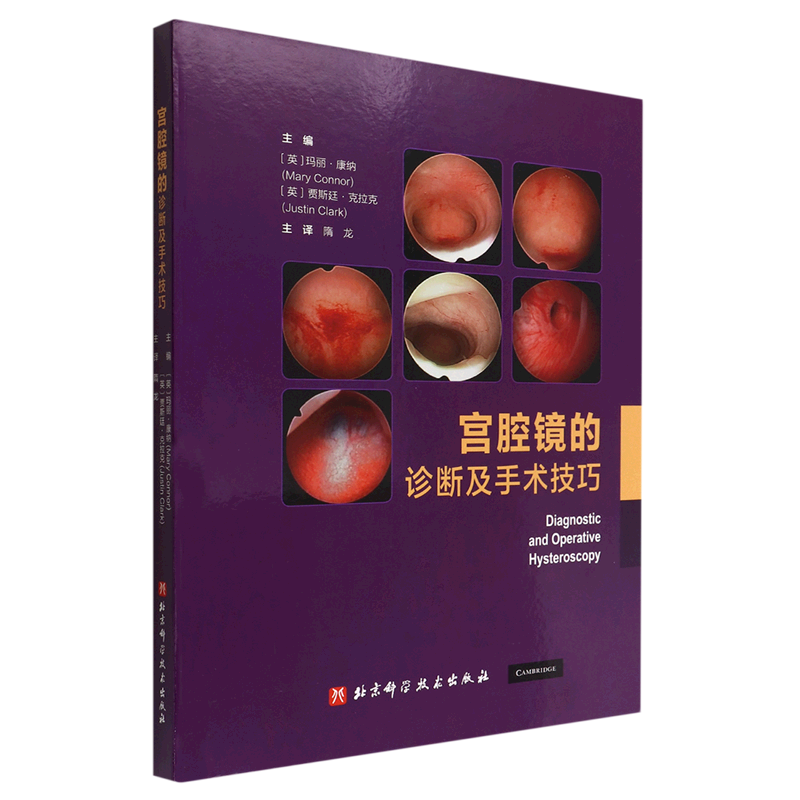 宫腔镜的诊断及手术技巧(精)