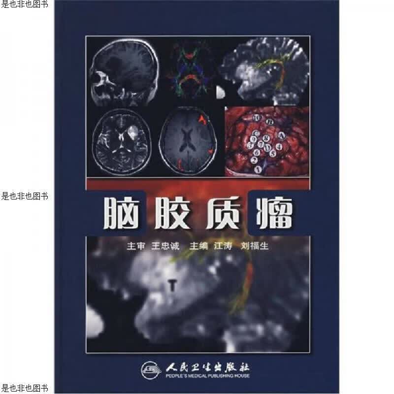 脑胶质瘤