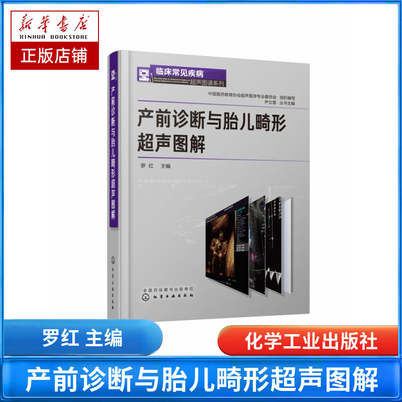 产前诊断与胎儿畸形超声图解(精)/临床常见疾病超声图谱系列