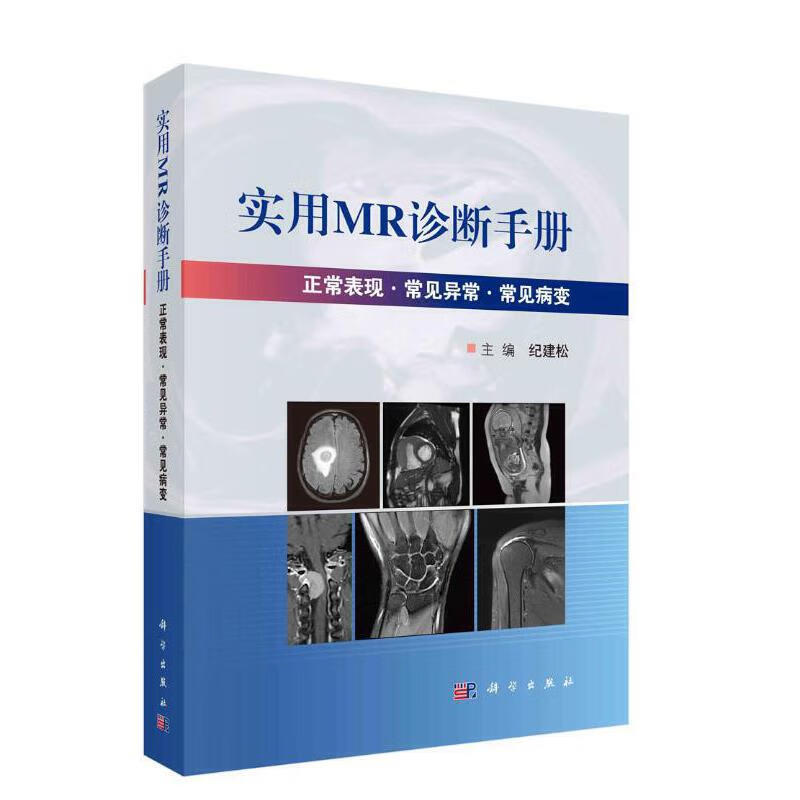 书籍 实用MR诊断手册 主编纪建松 科学出版社