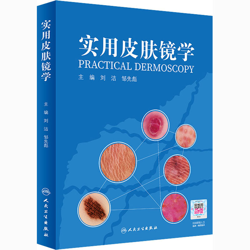 实用皮肤镜学 刘洁,邹先彪 编 皮肤、性病及精神病学