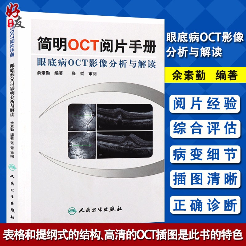 包邮 简明OCT阅片手册眼底病OCT影像分析与解读 俞素勤 人卫出版社 眼科医生的口袋书 眼科学