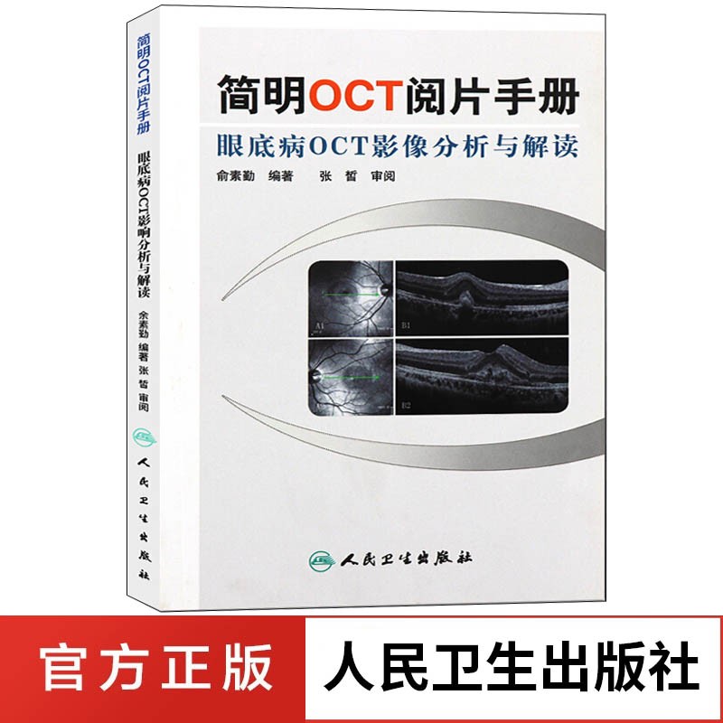 简明OCT阅片手册：眼底病影像分析与解读 眼科医学书籍