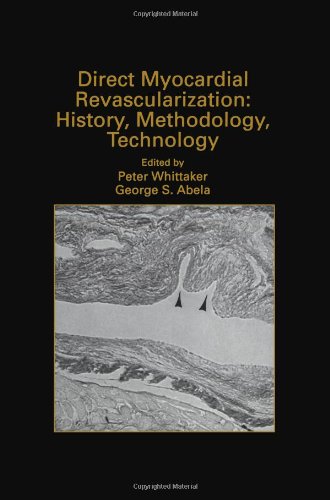 revascularization-千图网