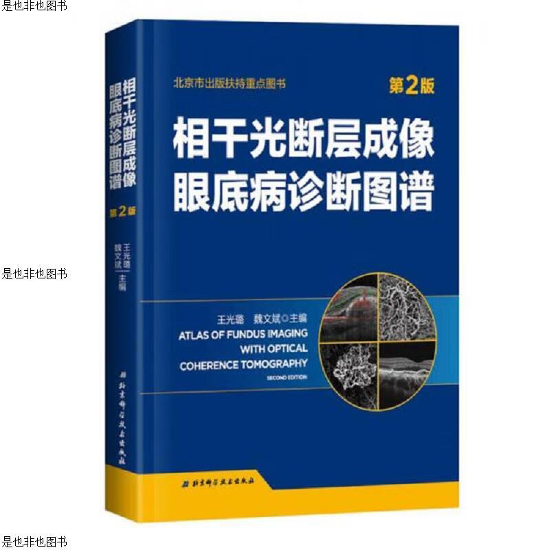 相干光断层成像眼底病诊断图谱 第2版