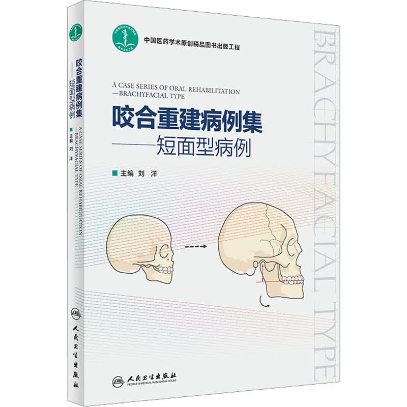 咬合重建病例集——短面型病例