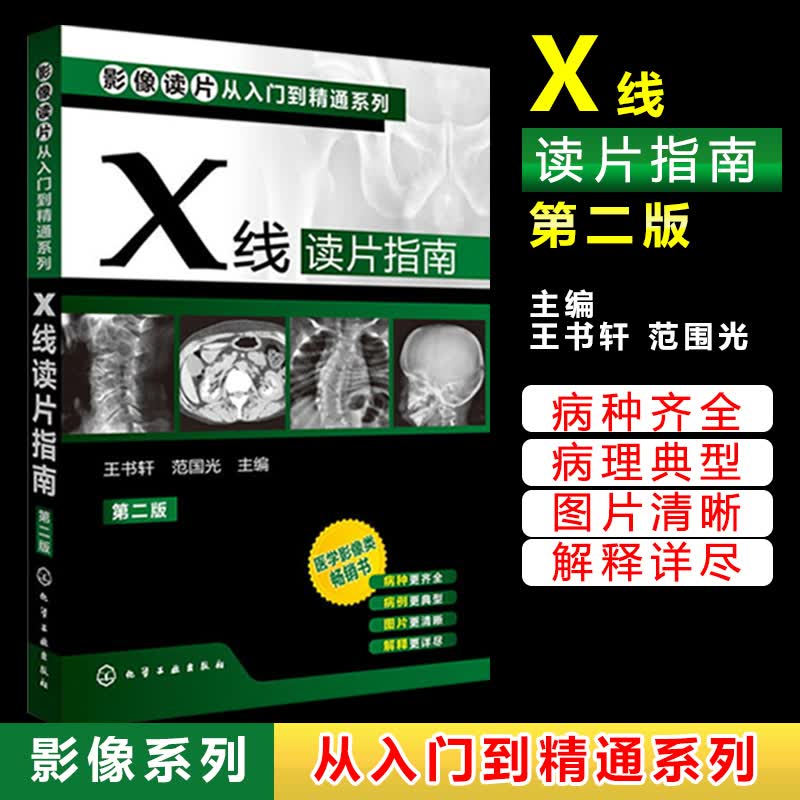 X线读片指南 第2二版 影像学医学类书 医学声影像学 X线诊断学 影像学诊断实用图谱 影像读片从