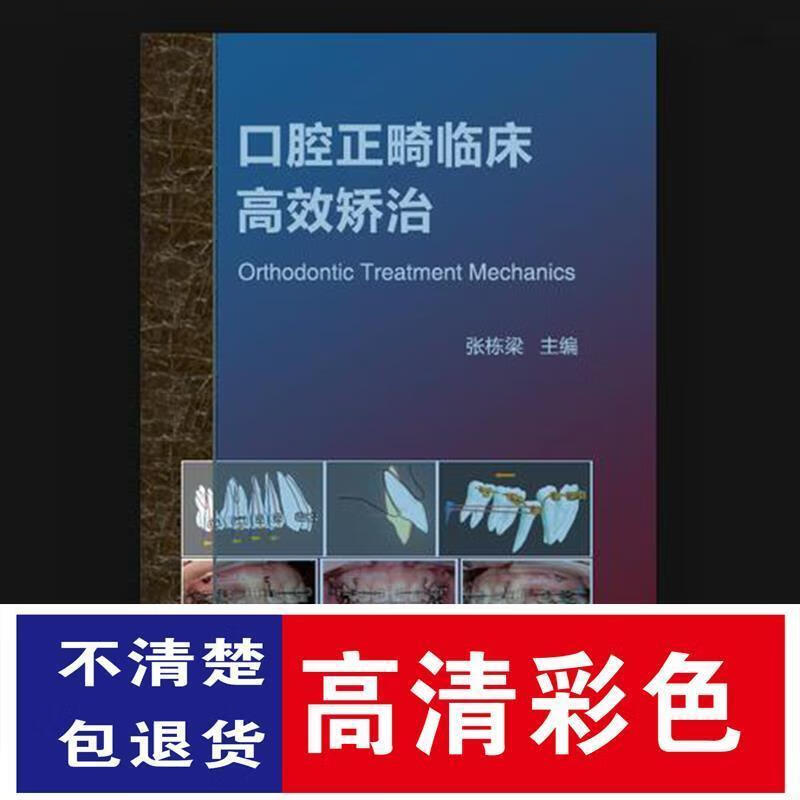 口腔正畸临床高效矫治