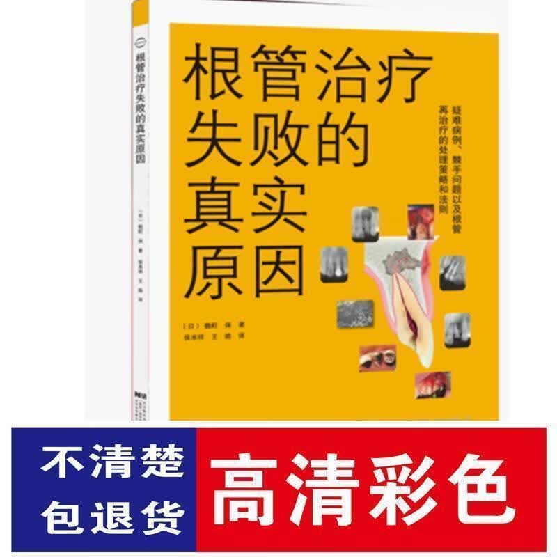 根管治疗失败的真实原因