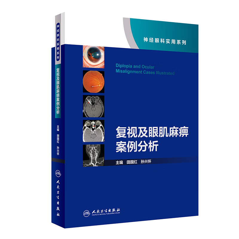 复视及眼肌麻痹案例分析 神经眼科实用系列神经眼科特殊病例书籍 神经眼科传出性障碍疾病治疗 医学眼科学9787117305334