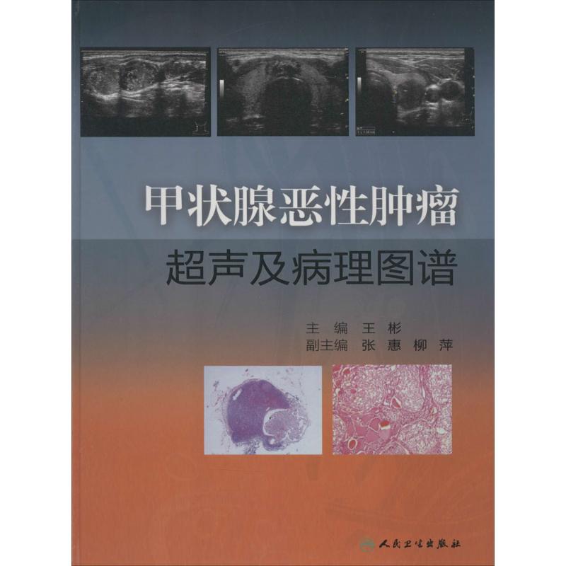 甲状腺恶性肿瘤超声及病理图谱