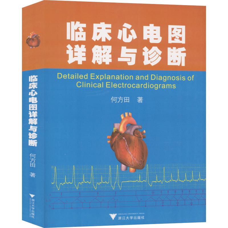 临床心电图详解与诊断