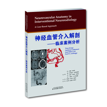 神经血管介入解剖—临床案例分析