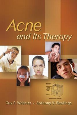 高被引Acne and Its Therapy
