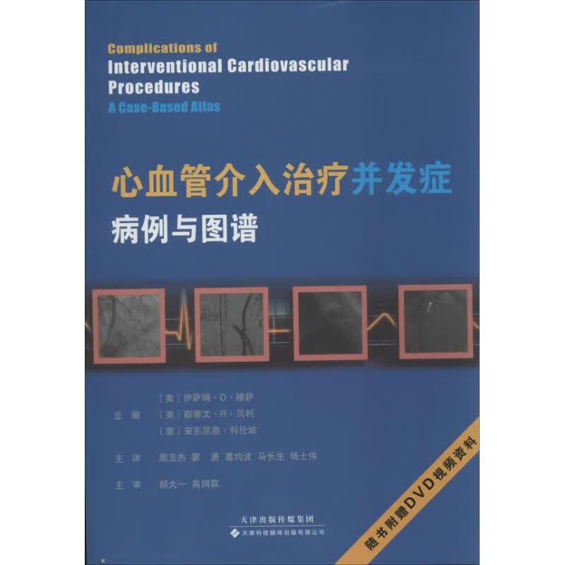 心血管介入治疗并发症