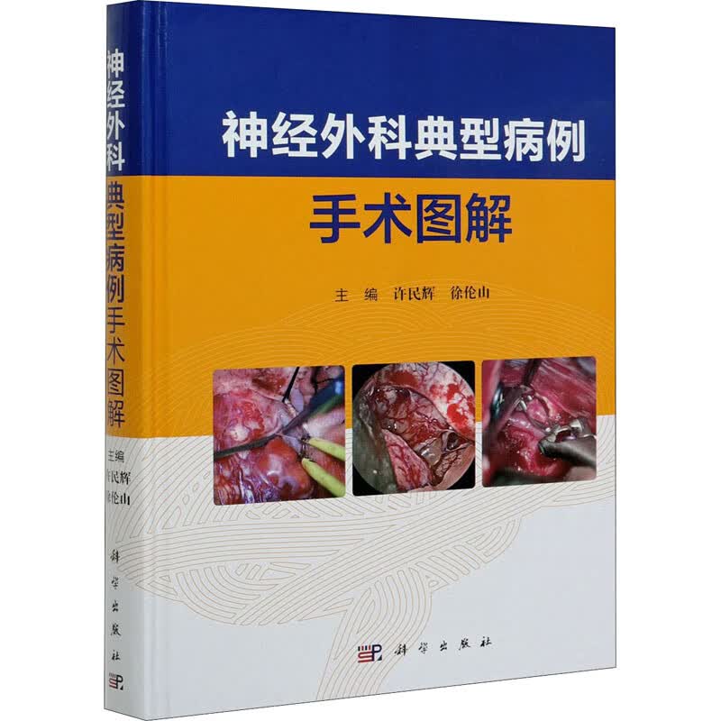 神经外科典型病例手术图解