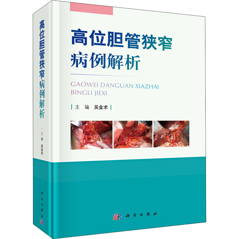 高位胆管狭窄病例解析 图书