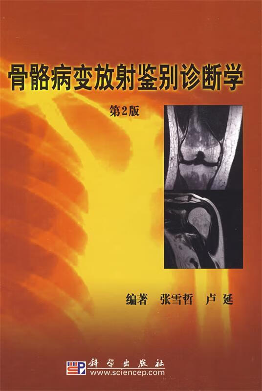【现货】骨骼病变放射鉴别诊断学