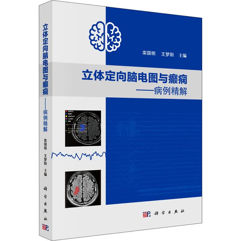 立体定向脑电图与癫痫——病例精解 图书