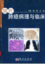 现代肺癌病理与临床 熊敏