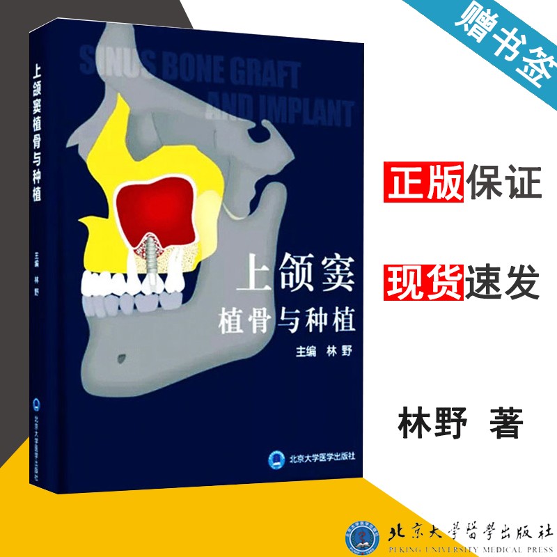 包邮 上颌窦植骨与种植 林野 北京大学医学出版社