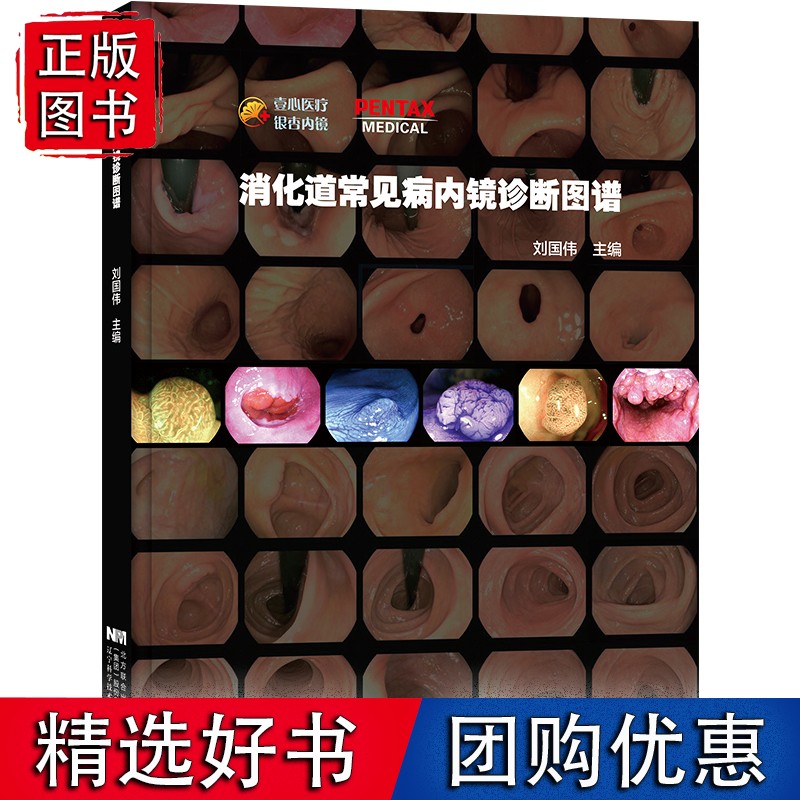 消化道常见病内镜诊断图谱