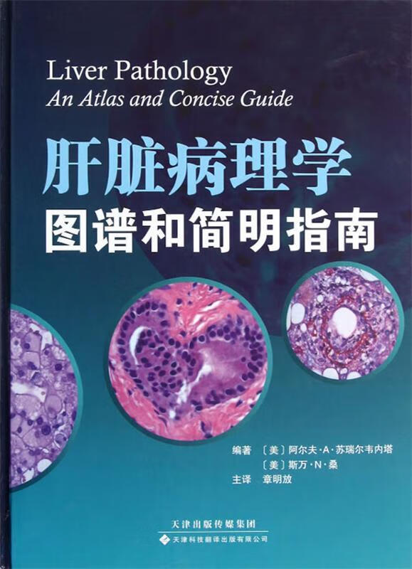 肝脏病理学图谱和简明指南 (美)苏瑞尔韦内塔,(美)桑编著,章明放等译