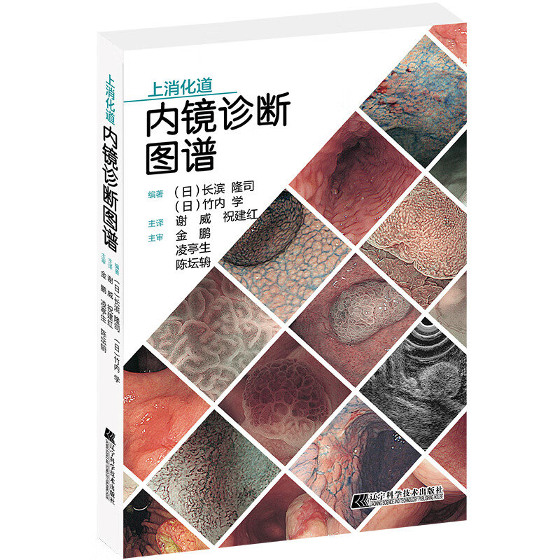 上消化道内镜诊断图谱 辽宁科学技术出版社 消化科医师参考书 消化道内镜检查技术 上消化道各种疾病诊断指南