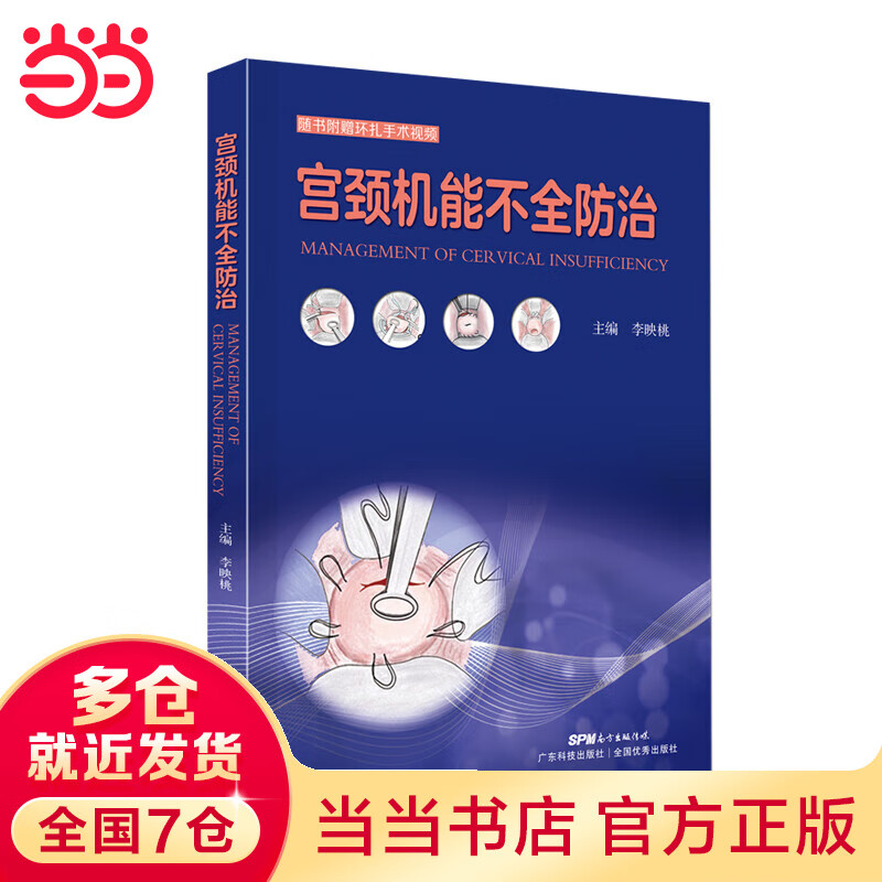 宫颈机能不全防治