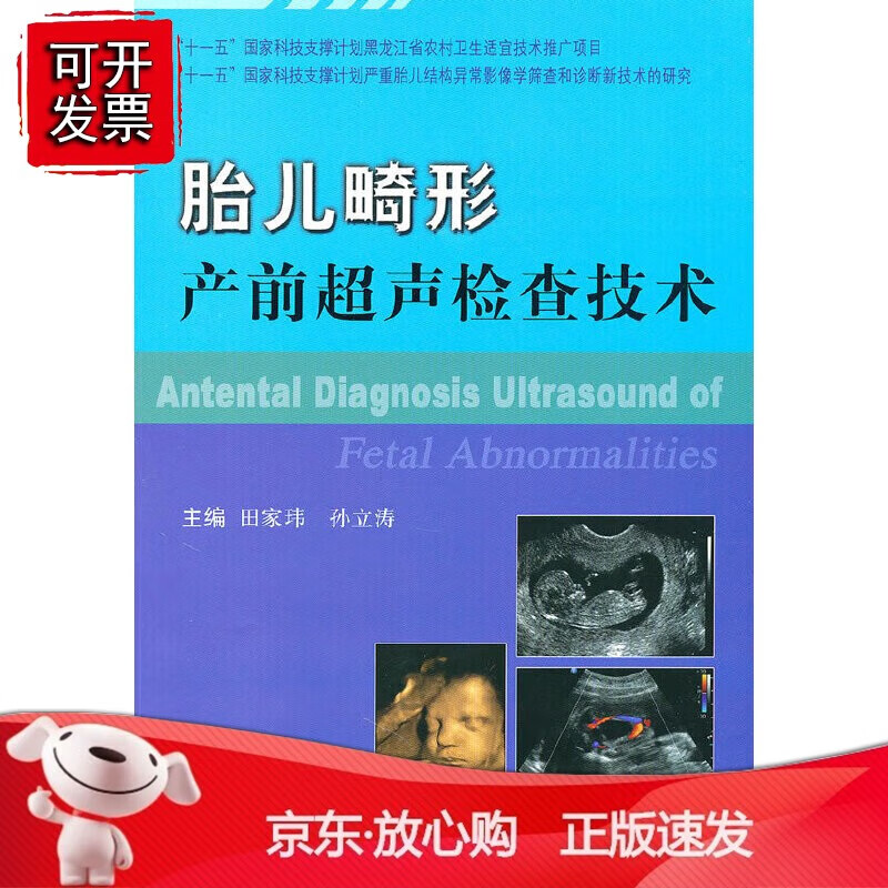 胎儿畸形产前超声检查技术