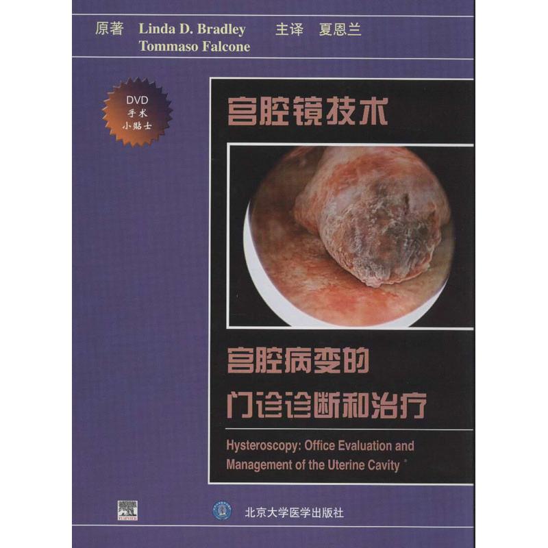 宫颈镜技术:宫腔病变的门诊诊断和治疗